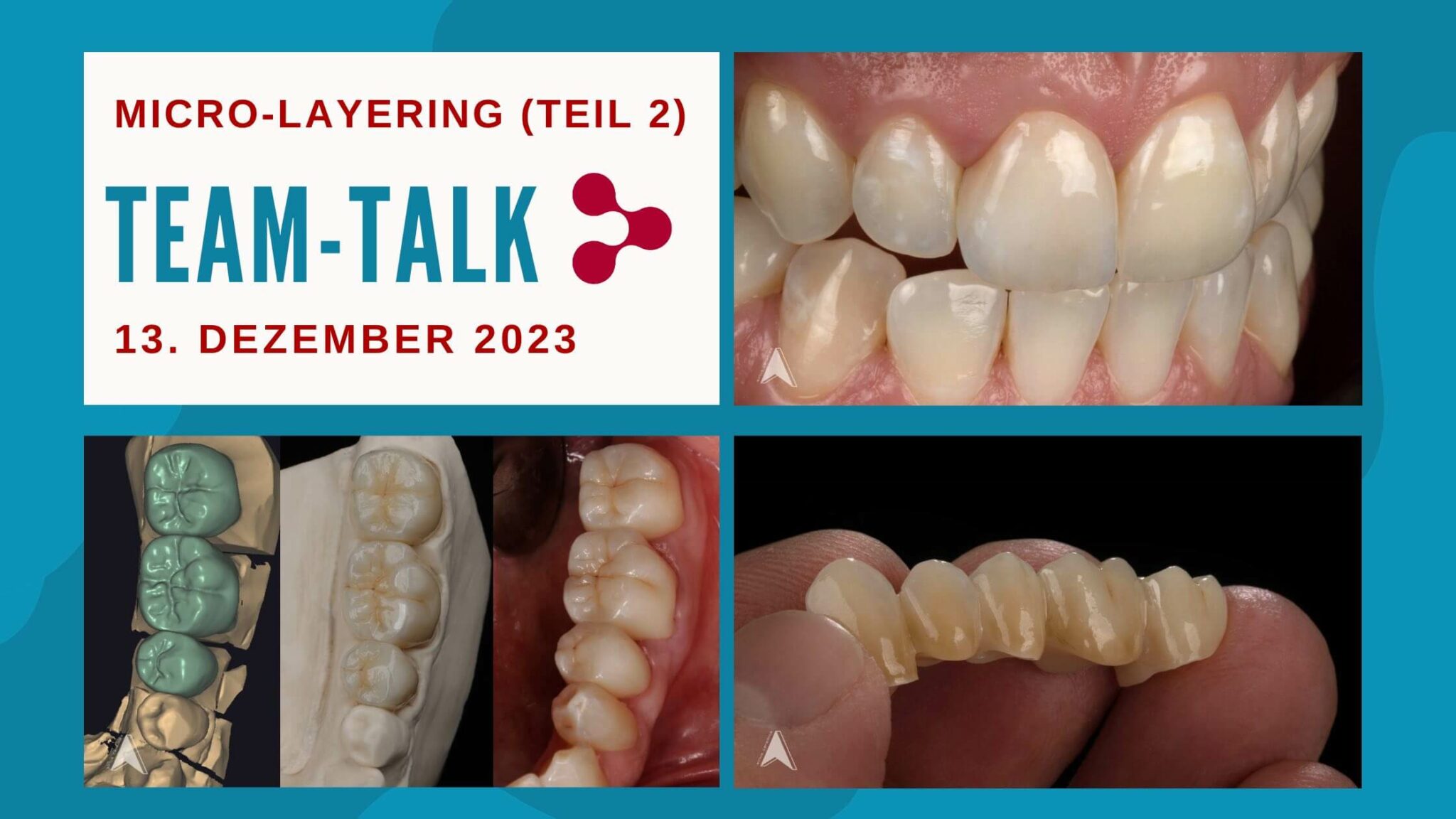 TEAM-Talk #5: Micro-Layering, Teil 2 - EADT